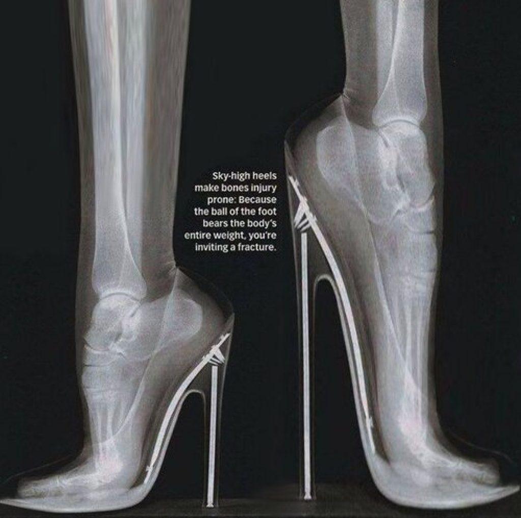 High Heel Hazards: Why High Heels Are Bad For Your Health - RunderWomen.com